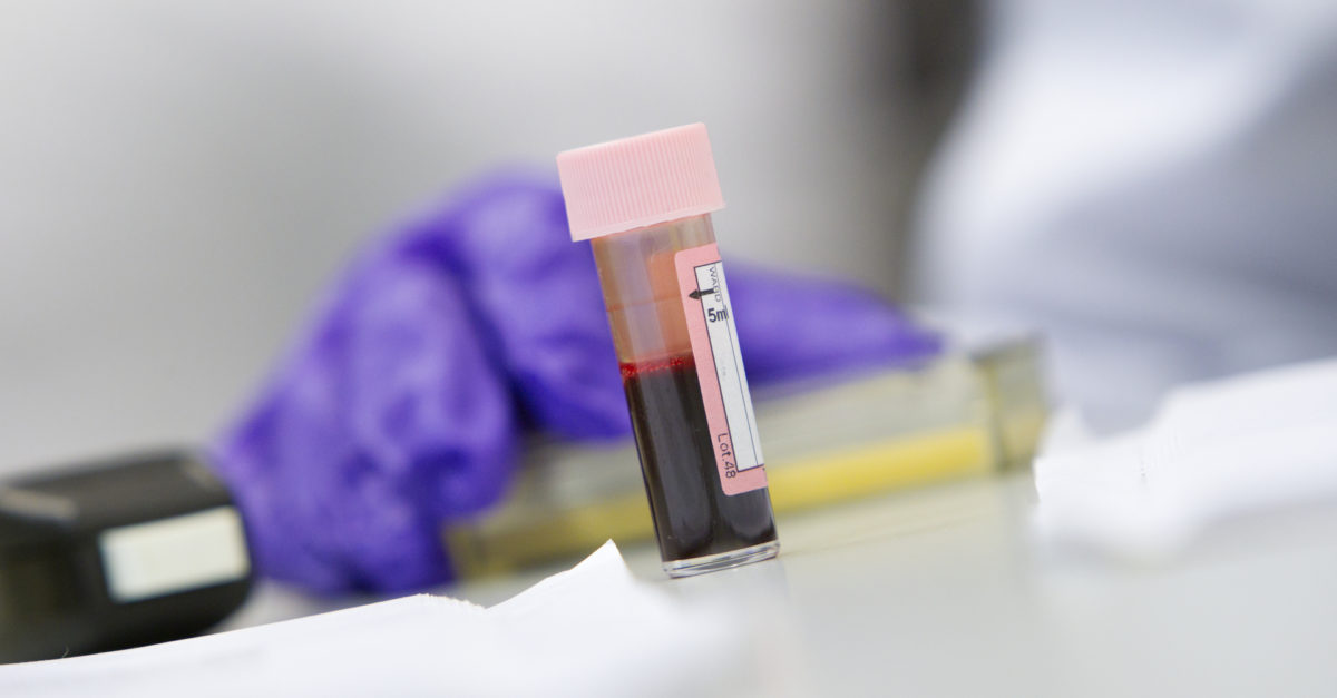 Simple blood test could save lives of thousands of heart attack ...