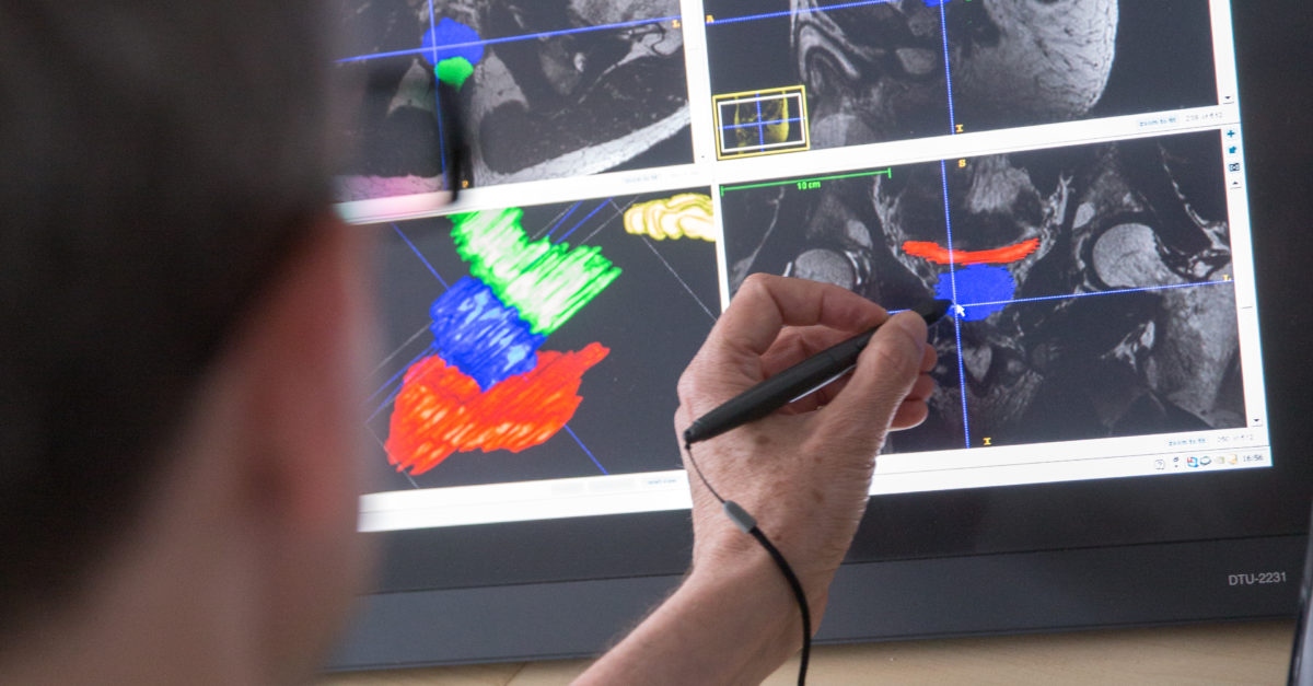 MRI scan is a superior screening test for prostate cancer – NIHR ...