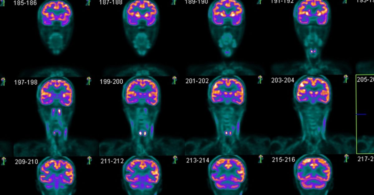 PET-MR symposium – NIHR Imperial Biomedical Research Centre