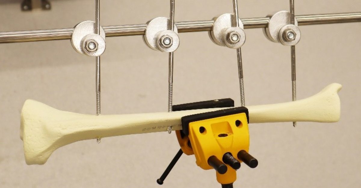 Imperial Designed External Fixator Aims to Cater to the High-conflict ...